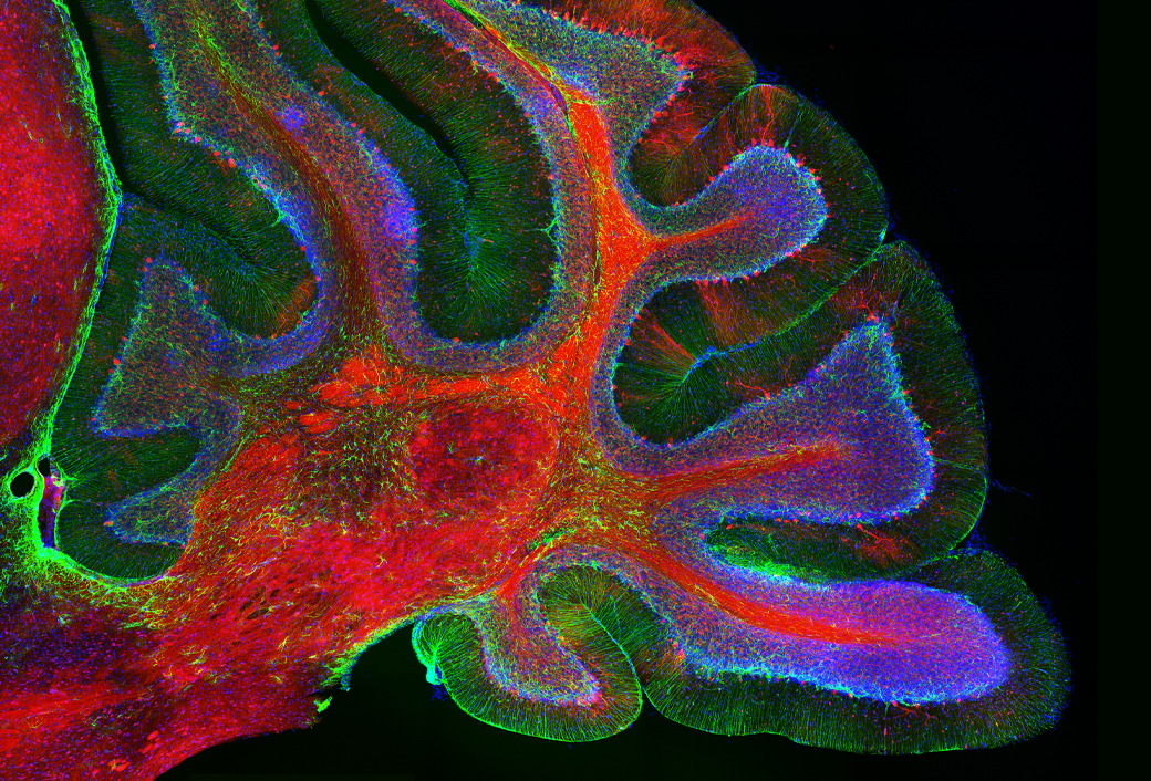 Imaging | Harvard Medicine Magazine