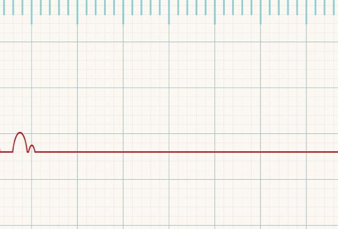 A Fine Line | Harvard Medicine Magazine