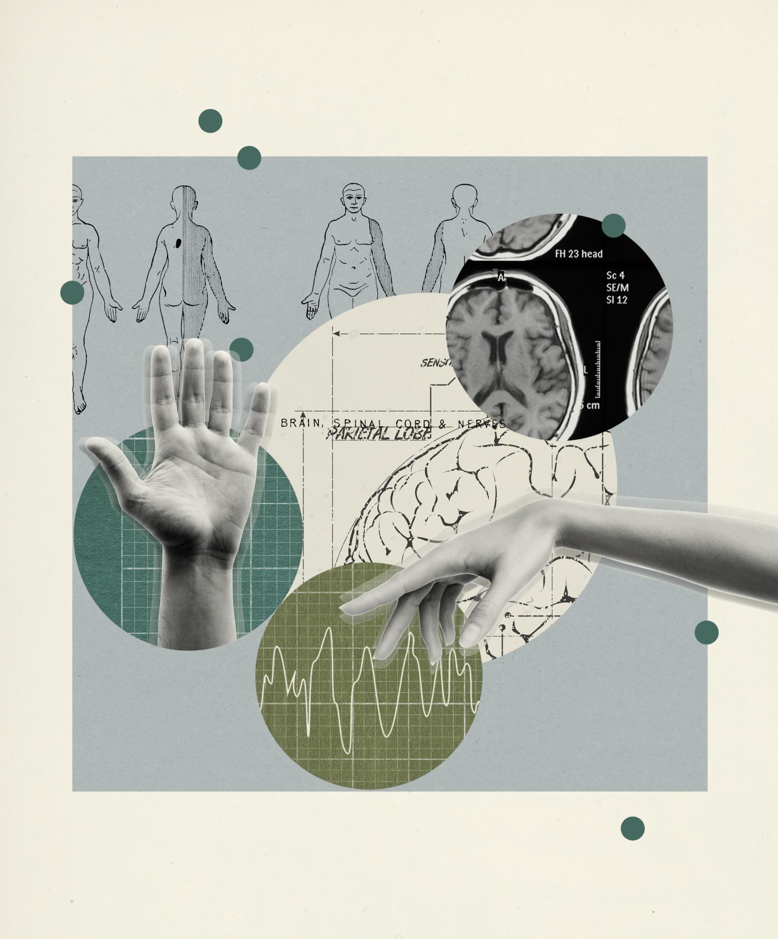 Functional Neurological Disorder, Reframed | Harvard Medicine Magazine