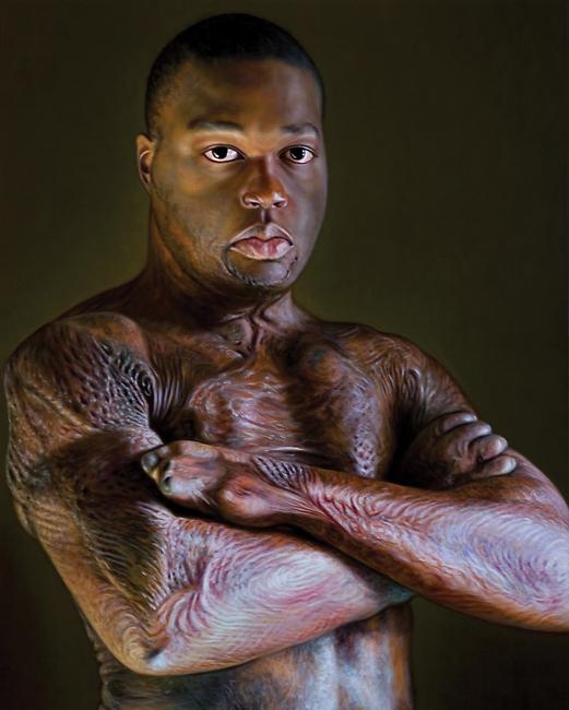 Surface Tension | Harvard Medicine Magazine