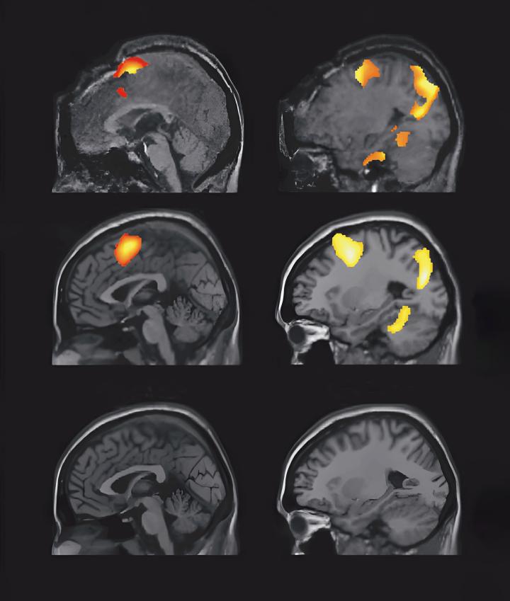 The Covert Consciousness Dilemma | Harvard Medicine Magazine
